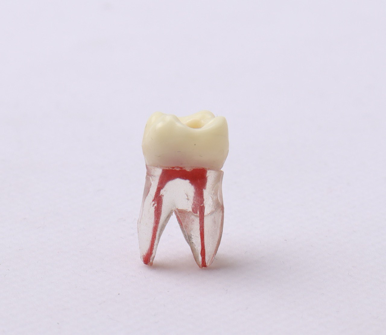 WinWay » Endo Teeth With Access Opening