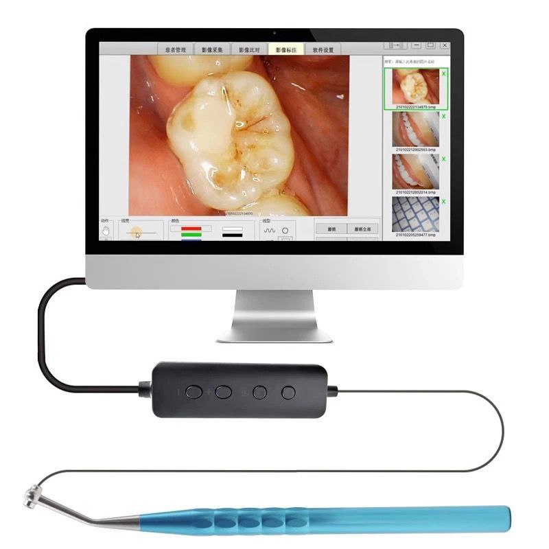 WinWay » Micro Endo Camera + intra oral + screen