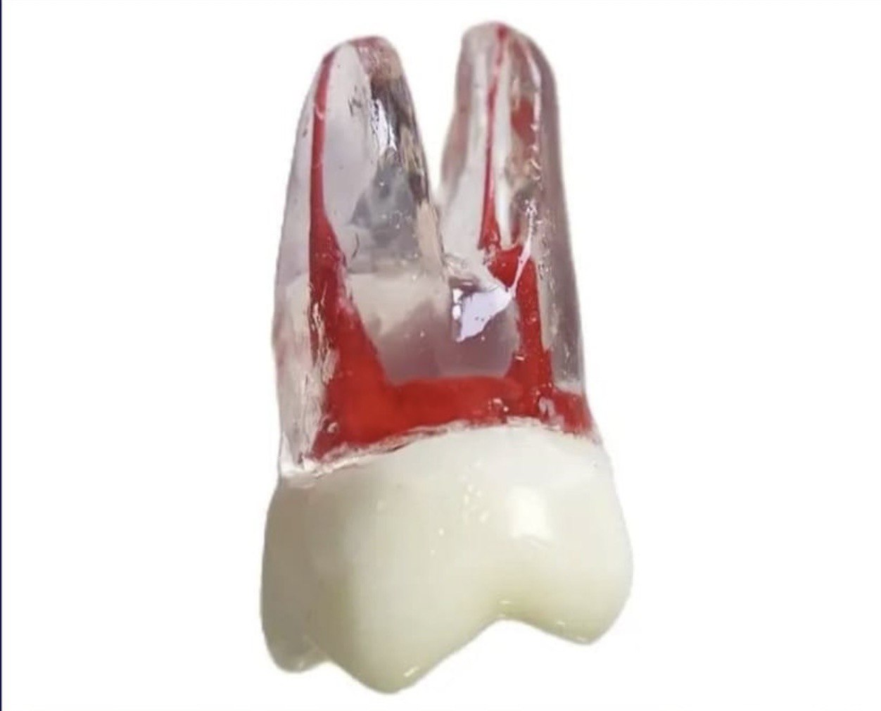 WinWay » Endo teeth